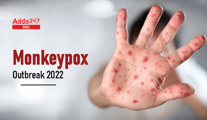 Monkeypox in India - Symptoms, Transmission and Prevention