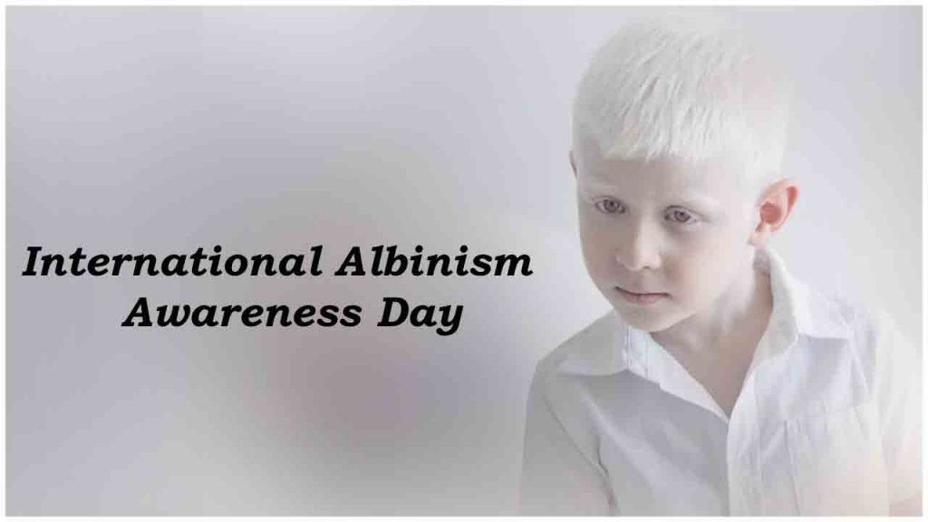 International Albinism Awareness Day: 13 June